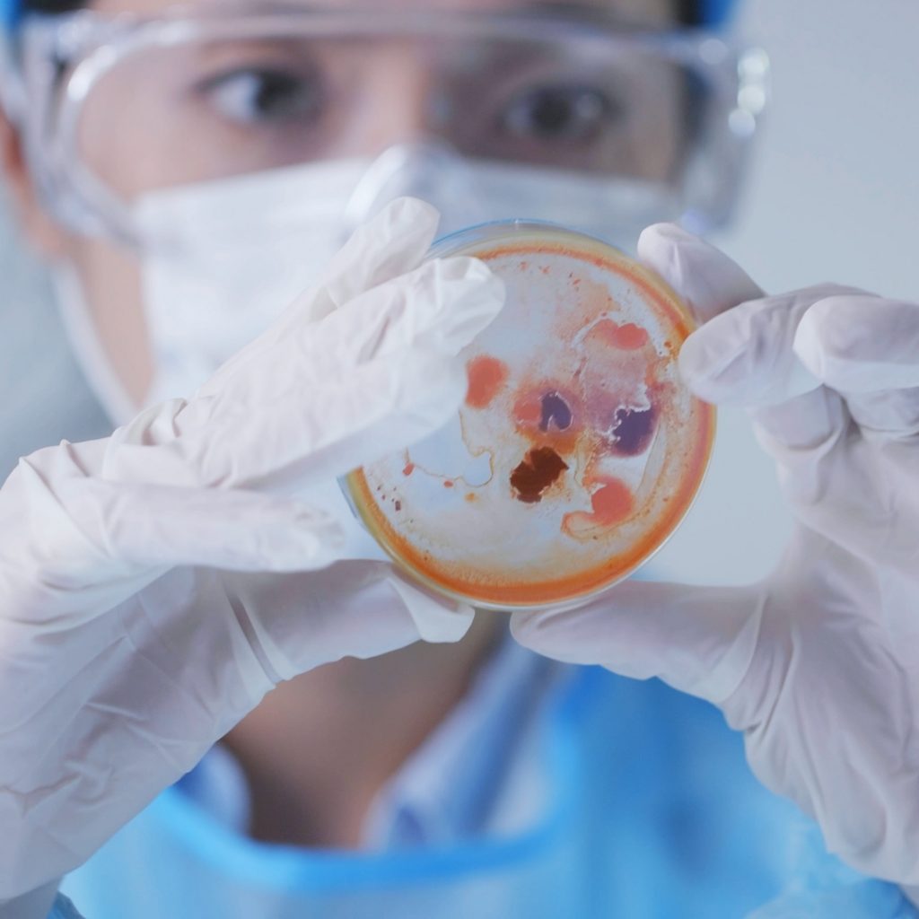 Coliformes Totais e Escherichia coli- Qualitativo – Soul Science